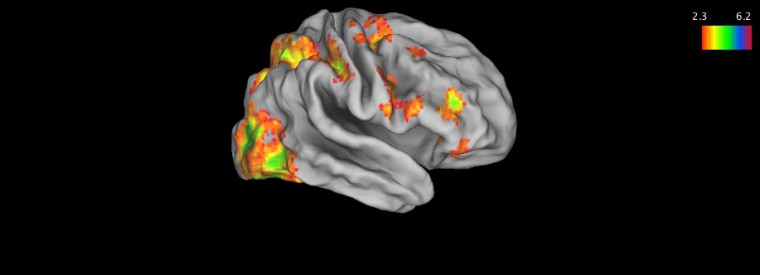 BRAIN SCAN – The UCLA Institute for Society and Genetics